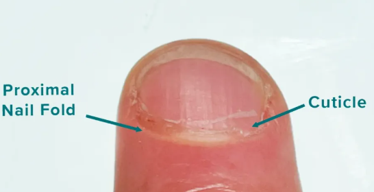 1.8 - Disease and Disorder of the Nail - Cornerstone Canadian Institute